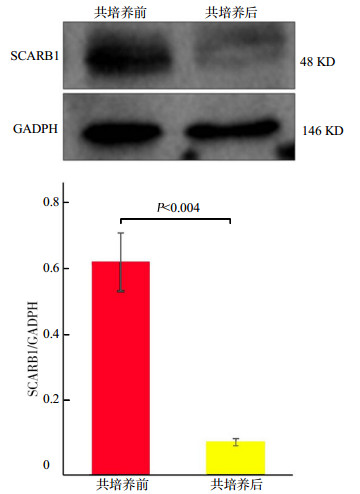 Study on SCARB1 mediated coagulation dysregulation in recipients after ...