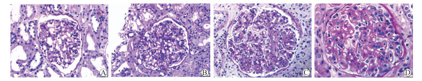 慢性移植肾功能不全诊疗技术规范(2019版)